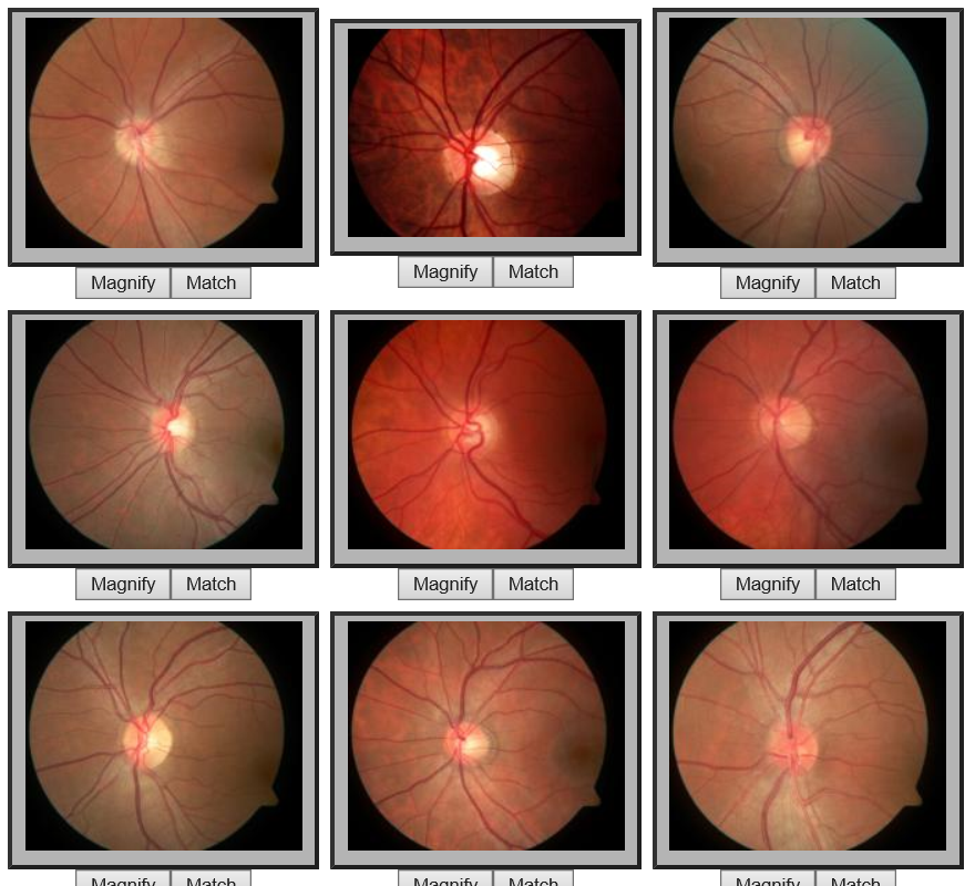 Eye Exam Simulator (Php/MySQL) | Kingston Data & Web
